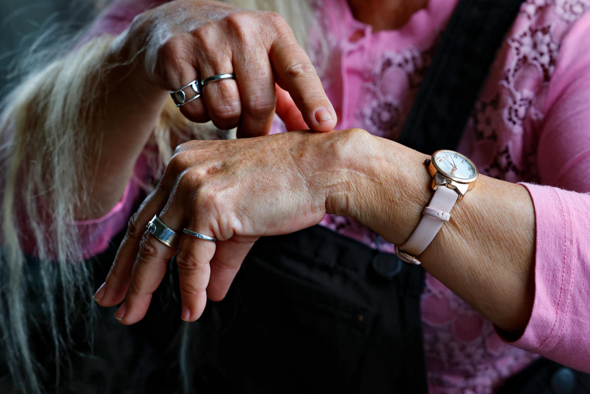 46 år gammel skled Liv på et svaberg og brakk armen. De neste tolv ... 46 år gammel skled Liv på et svaberg og brakk armen. De neste tolv ...
